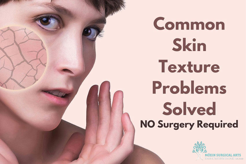 Skin Texture Problems Solved without Surgery in Los Angeles, CA